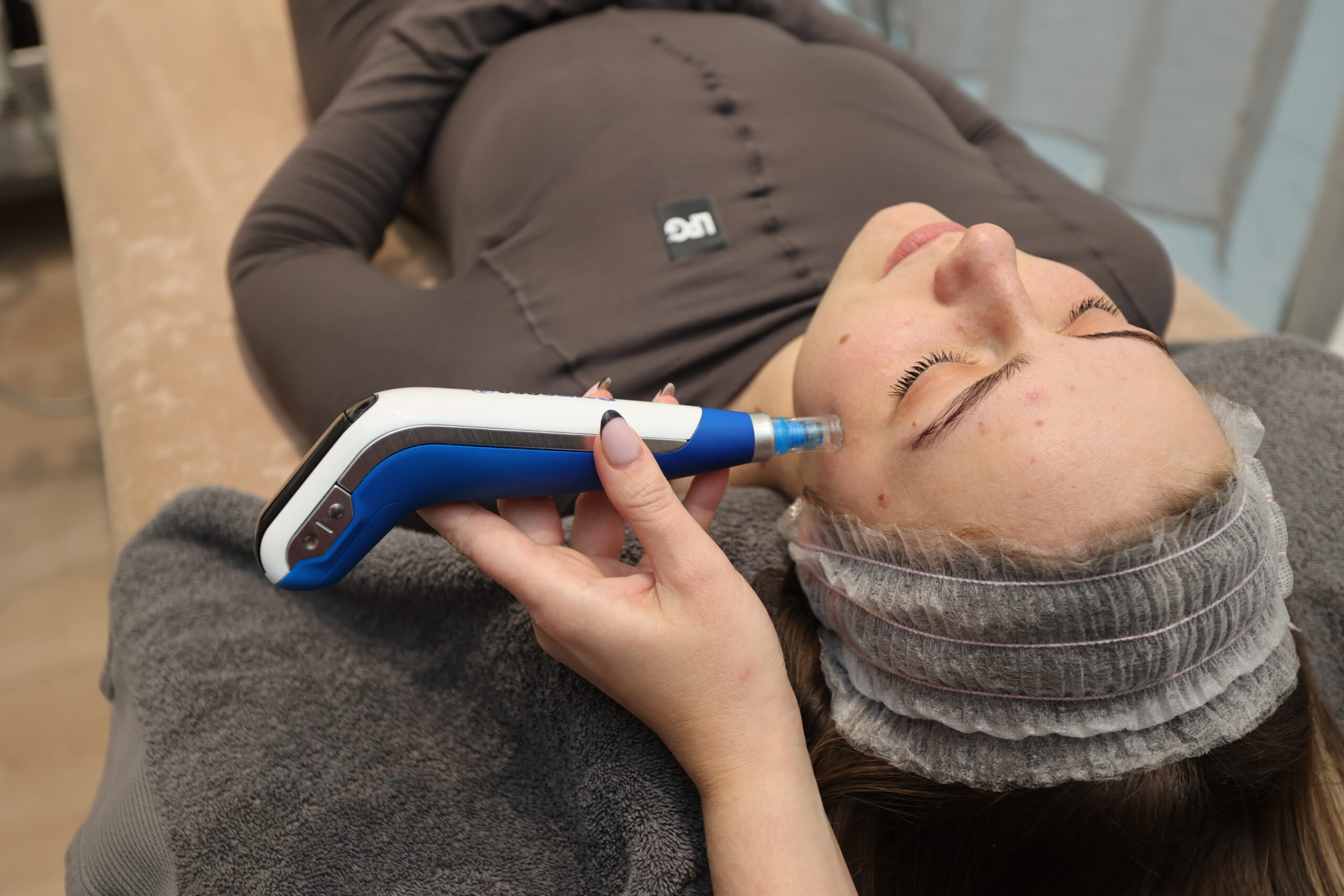 Dermapen visage - Endermospa LPG
